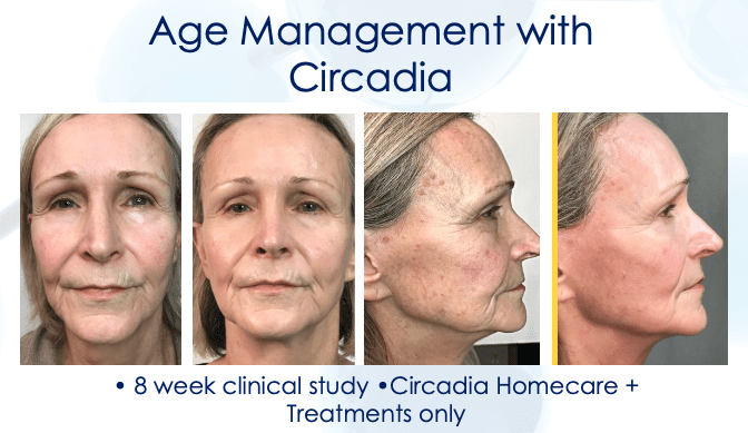 Circadia® Corrective Treatments – Skin Solutions Mediclinic